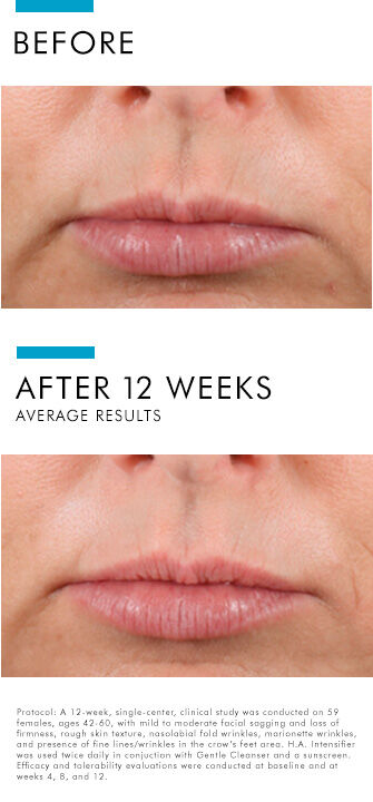 skinceuticals-hydracorrect