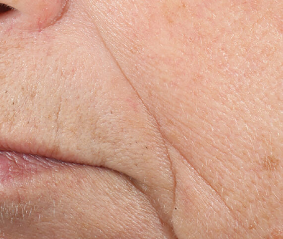 Power To Become: Achieve Your Best Skin Yet - SkinCeuticals