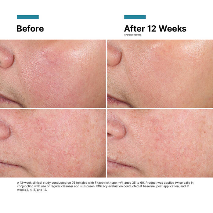 Advanced RGN-6 Skin Rejuvenation and Repair Cream | SkinCeuticals