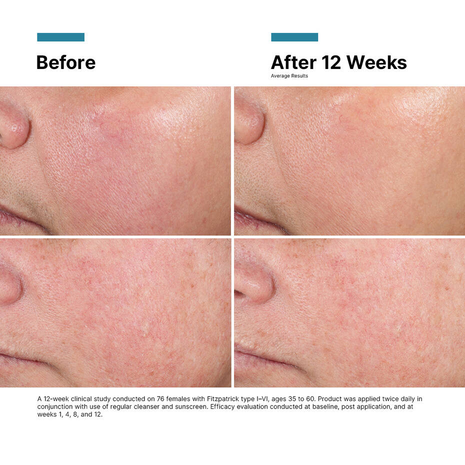 Advanced RGN-6 Skin Rejuvenation and Repair Cream | SkinCeuticals